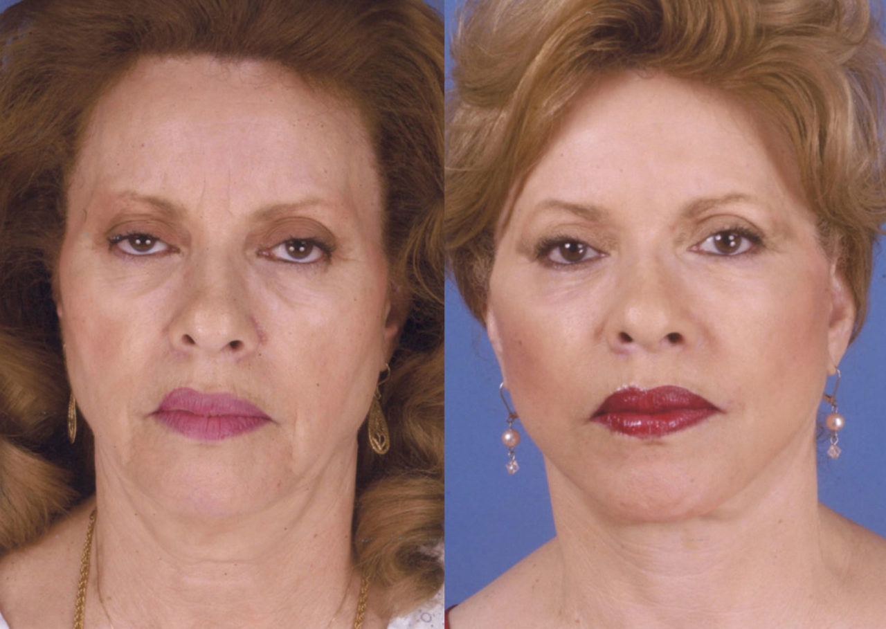 Plastic & Reconstructive Surgery in NYC | James P. Bradley, MD